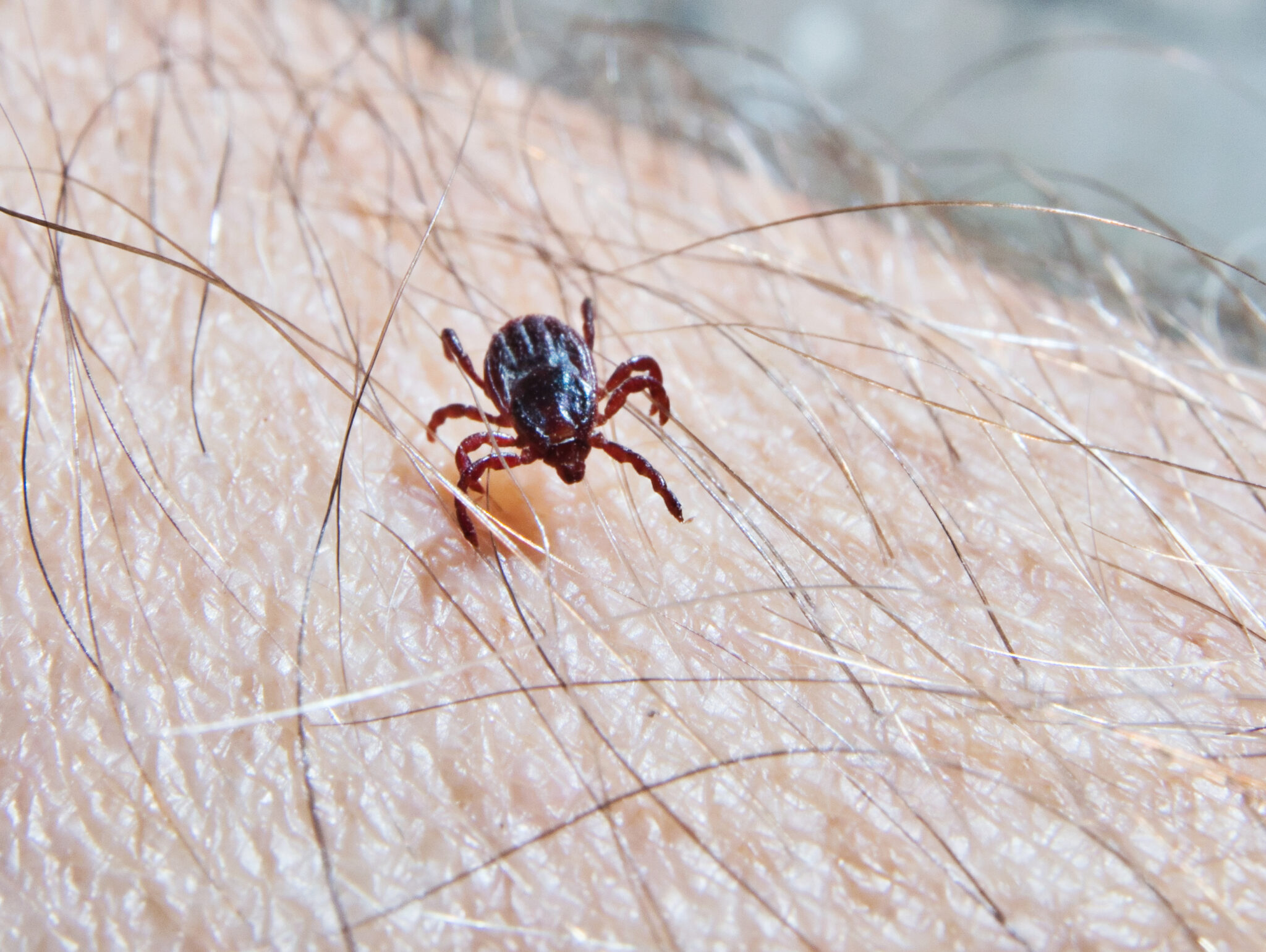 Understanding and Preventing Lyme Disease - OutDoorHerald